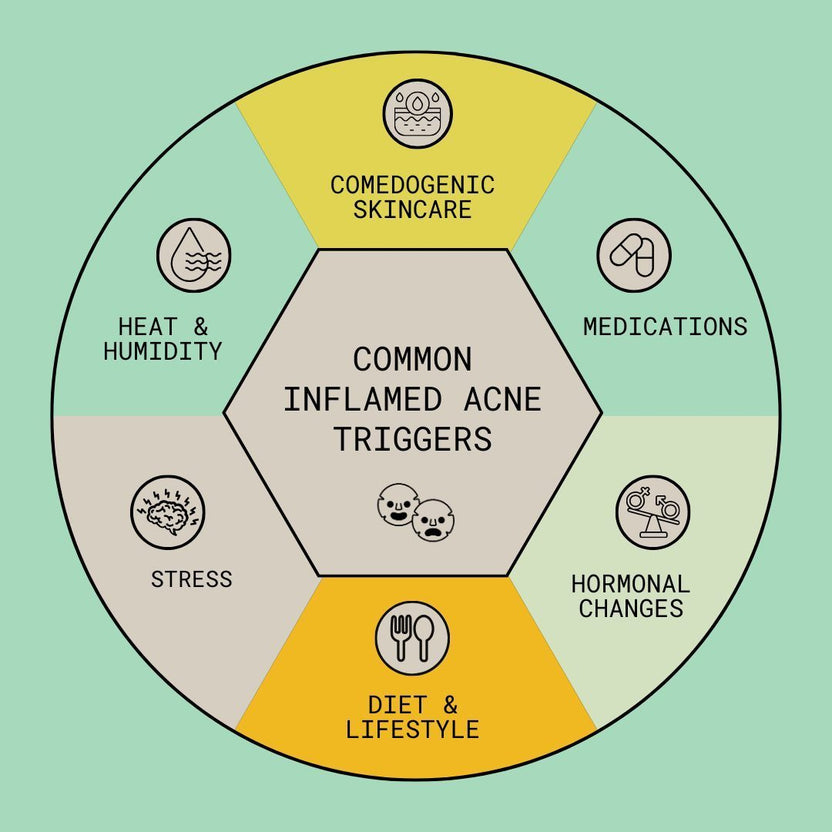What Is Inflamed Acne? | Sofie Pavitt Face